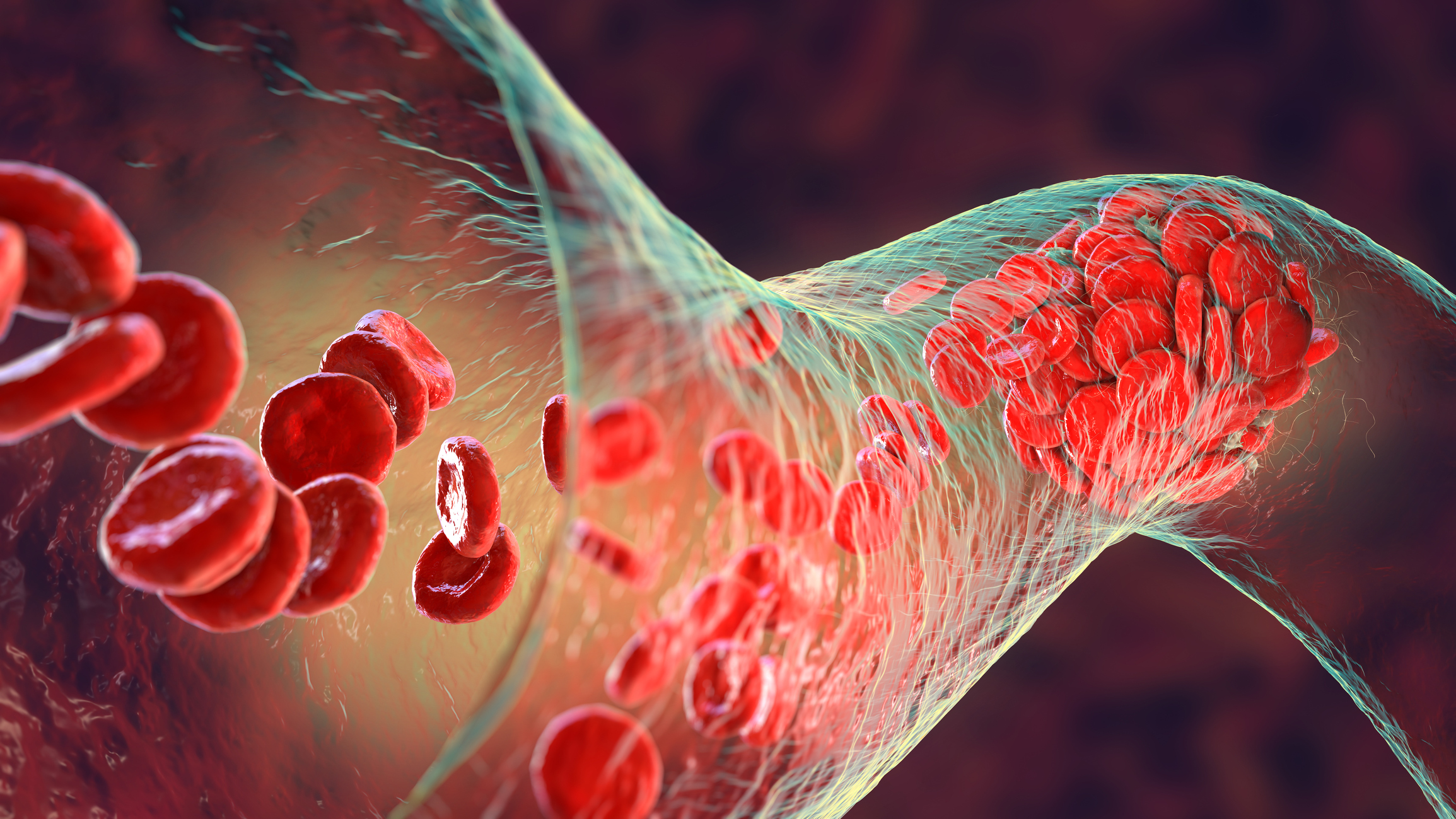 Importance of Arterial Elasticity